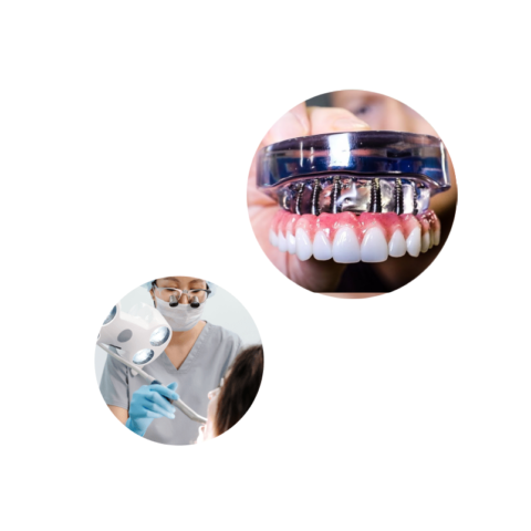 Proteza fixa pe implanturi - Cabinet Stomatologic DentPlus